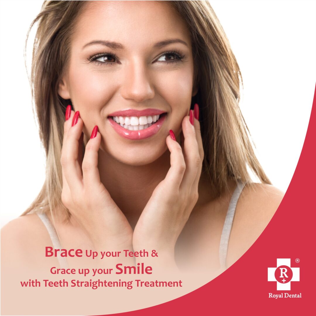 Beauty Beyond Straight Teeth - Royal Dental Clinics Blog