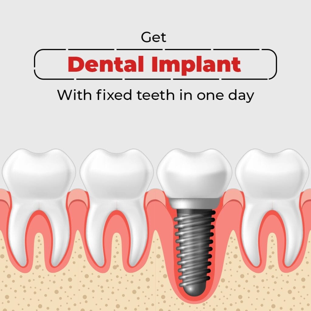 Smile and Teeth fixing in one day is now possible - Royal Dental Clinics